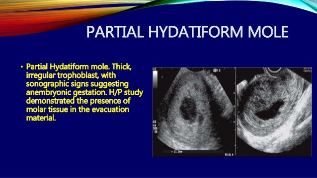 First trimester ultrasound Dr. Muhammad Bin Zulfiqar