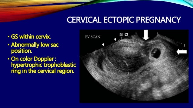 First trimester ultrasound Dr. Muhammad Bin Zulfiqar