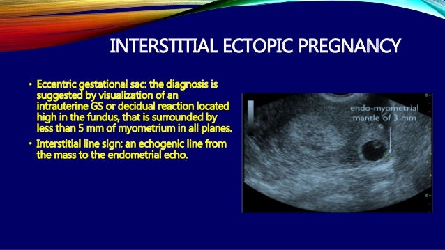 First trimester ultrasound Dr. Muhammad Bin Zulfiqar