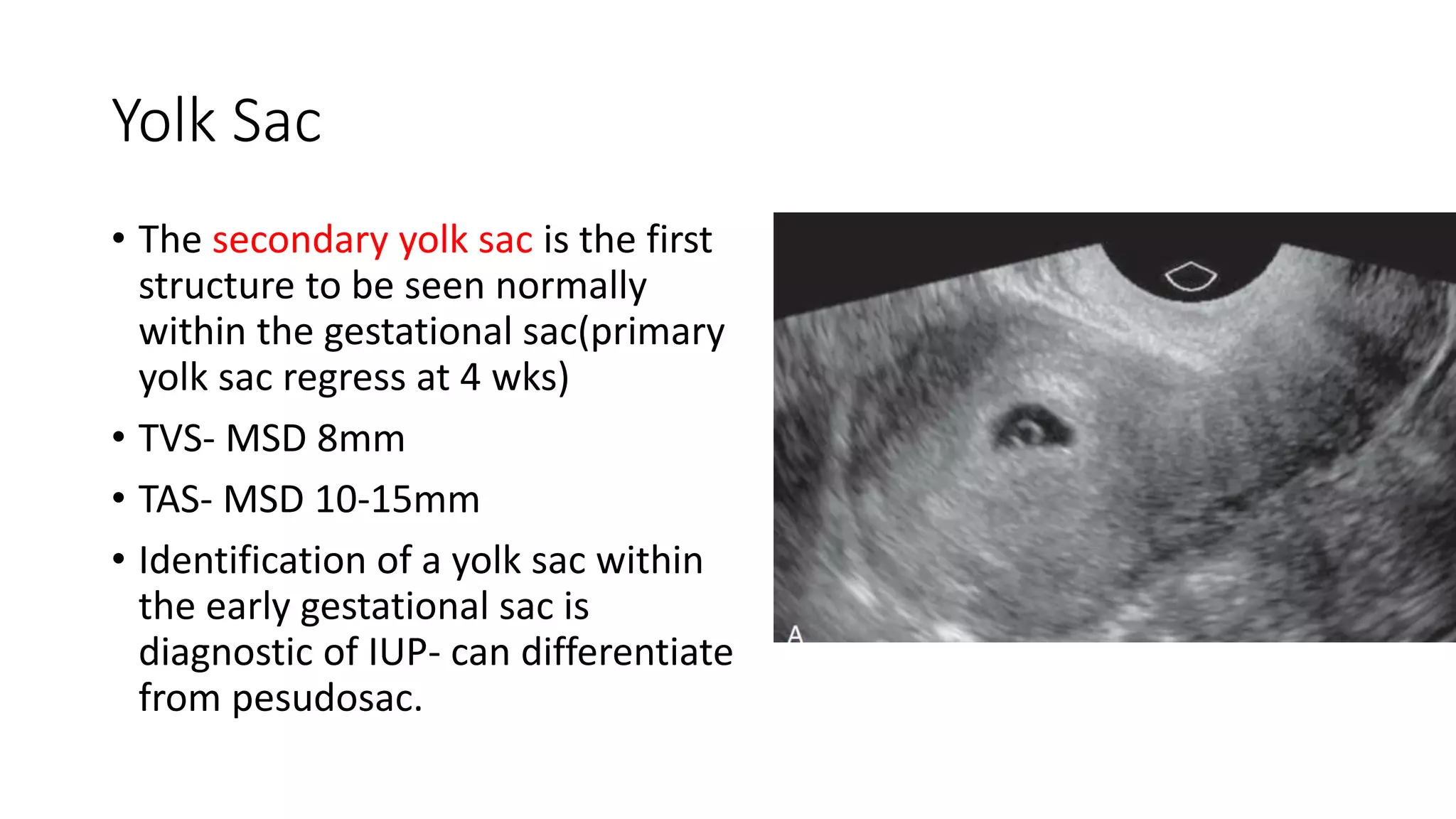 First trimester USG | PPTX