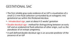 First trimester USG | PPTX