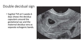 First trimester USG | PPTX