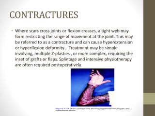 laceration and management for Ist year students.pptx