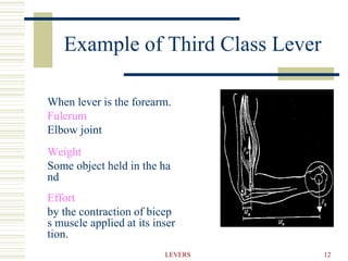 Levers in Physiotherapy | PPTX