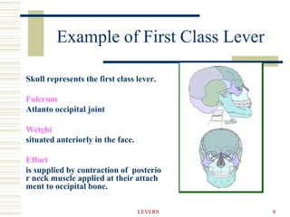 Levers in Physiotherapy | PPTX