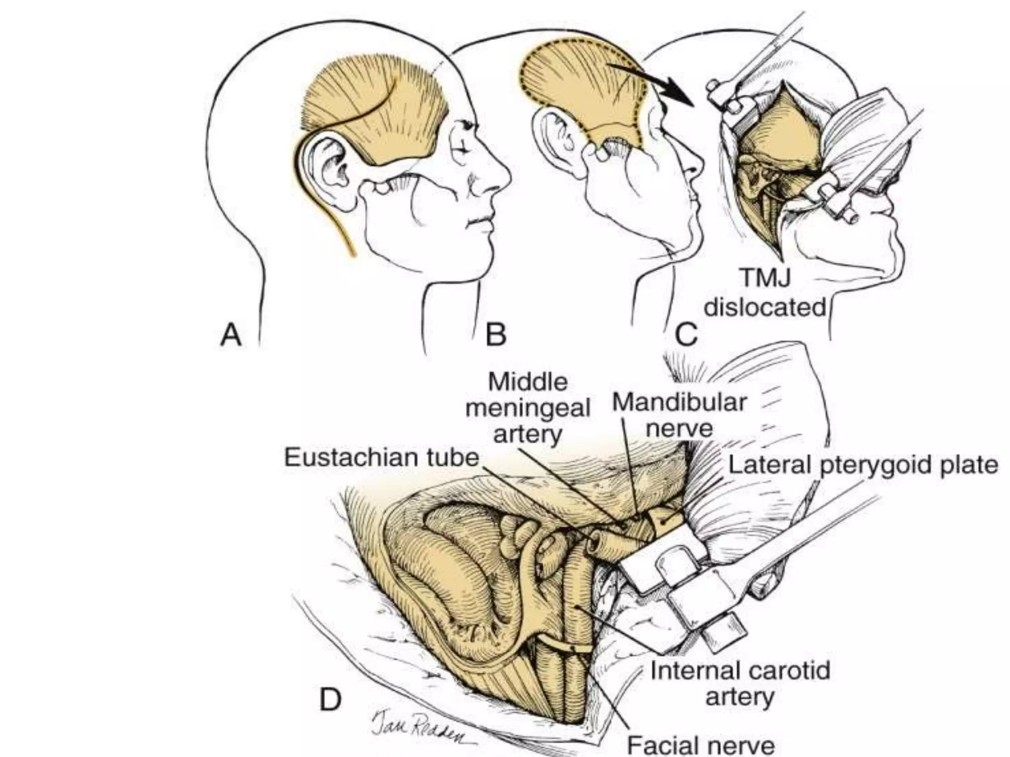 Fisch approaches Dr Zeeshan Ahmad | PPTX