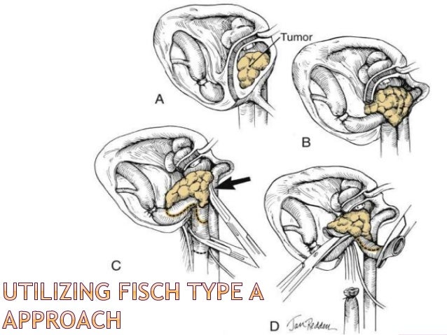 Fisch approaches Dr Zeeshan Ahmad