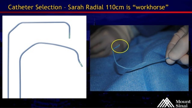 Fischman AM - AIMRADIAL 2014 Endovascular - Interventional radiology