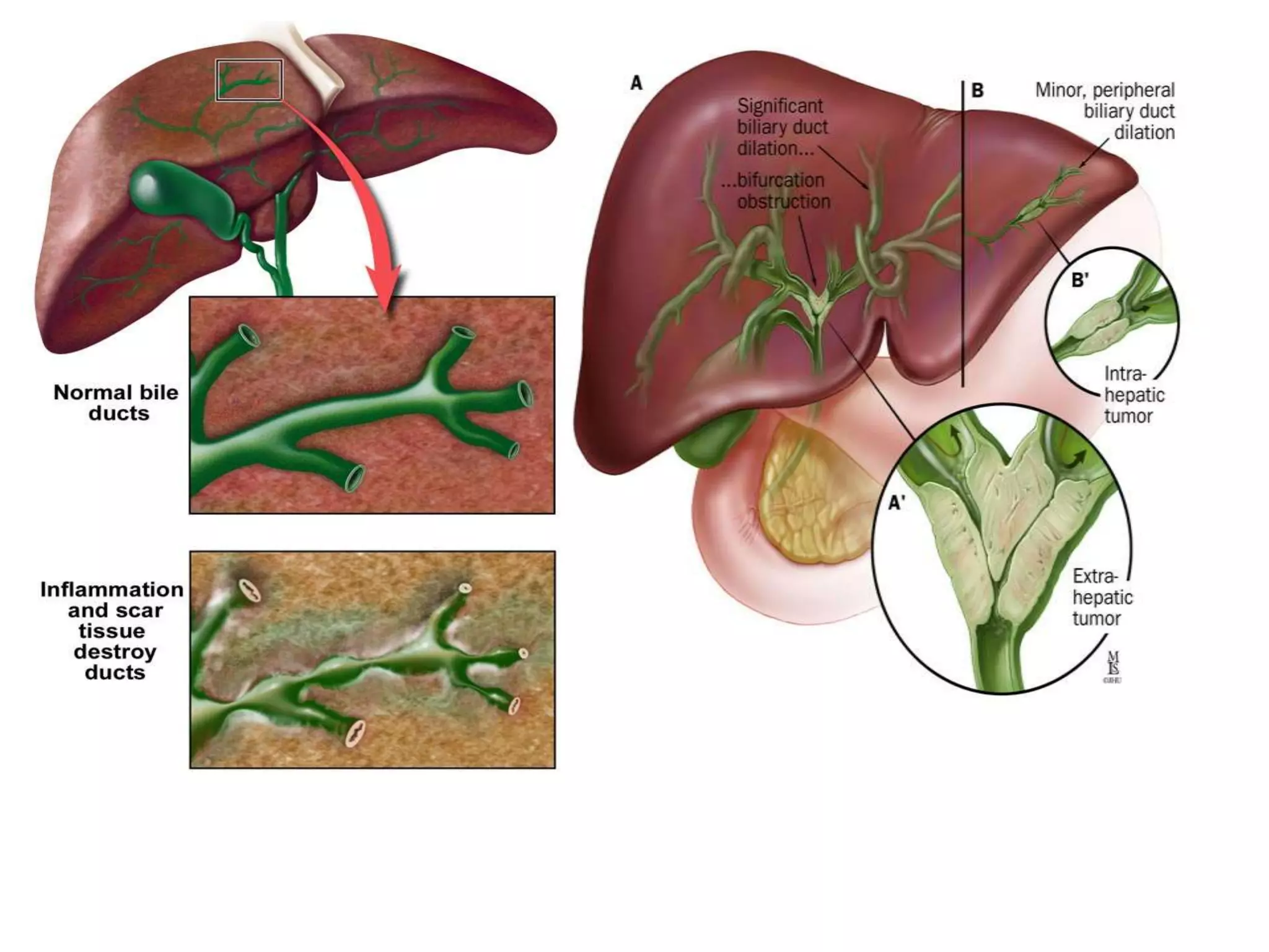 Fish borne parasitic zoonoses | PPTX
