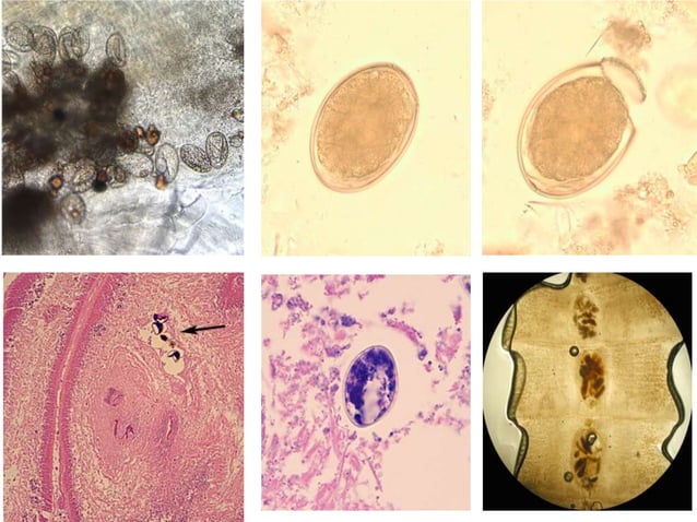 Fish borne parasitic zoonoses | PPTX | Infectious Diseases | Diseases ...