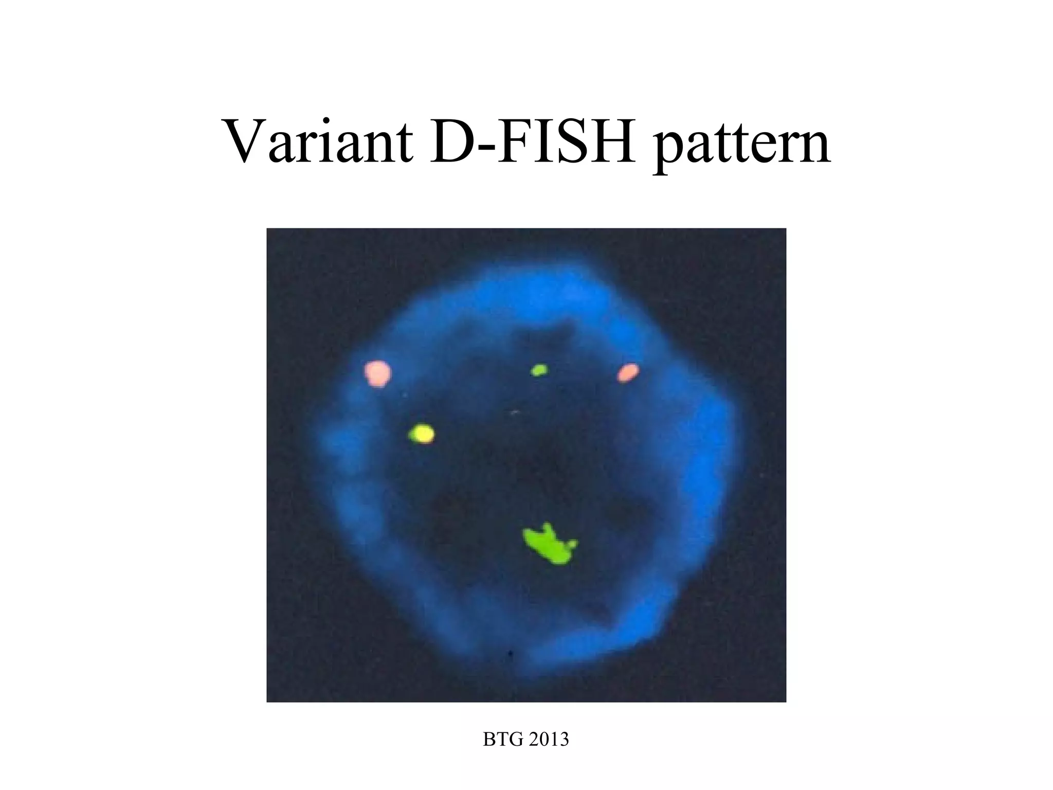Application of FISH in hematologic malignancies | PPT