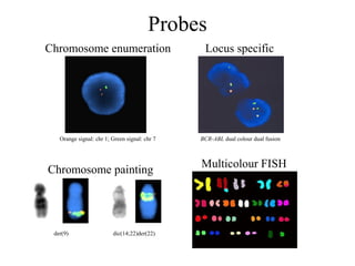 Application of FISH in hematologic malignancies | PPT