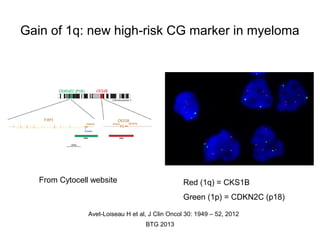 FISH IN MYELOMA | PPT | Free Download