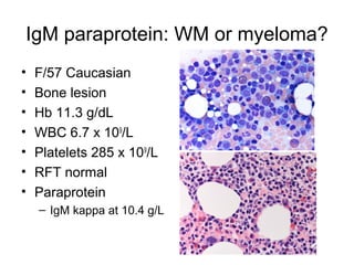 FISH IN MYELOMA | PPT
