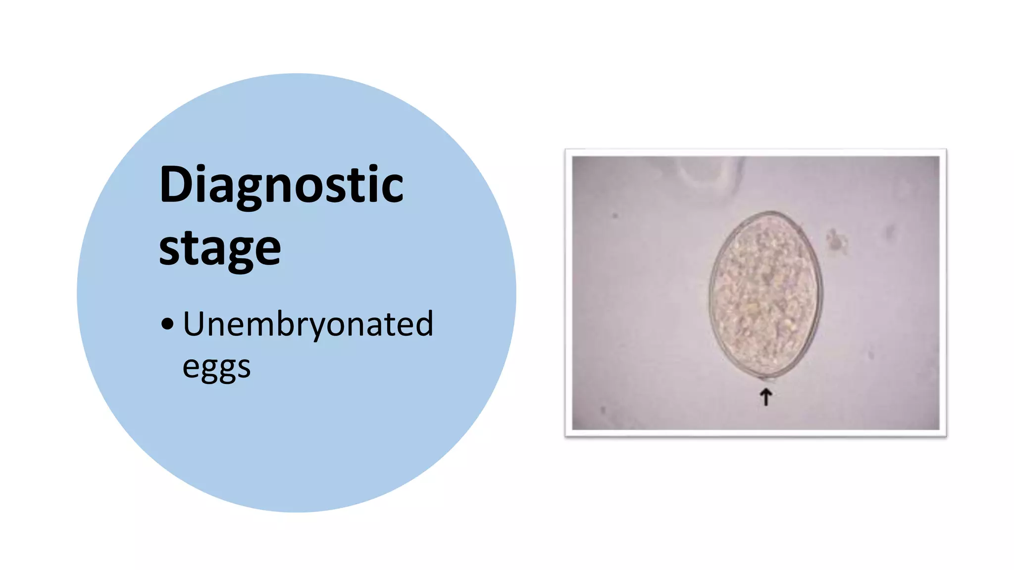 Fish tapeworm | PPTX | Digestive Disorders | Diseases and Conditions