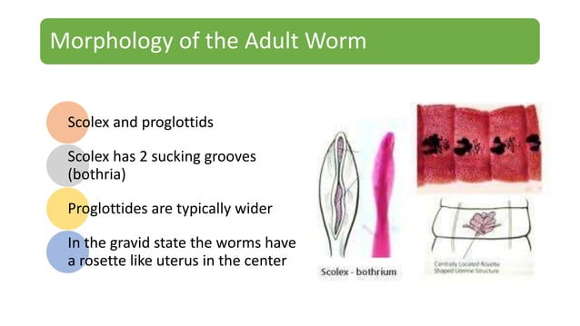 Fish tapeworm | PPTX | Digestive Disorders | Diseases and Conditions