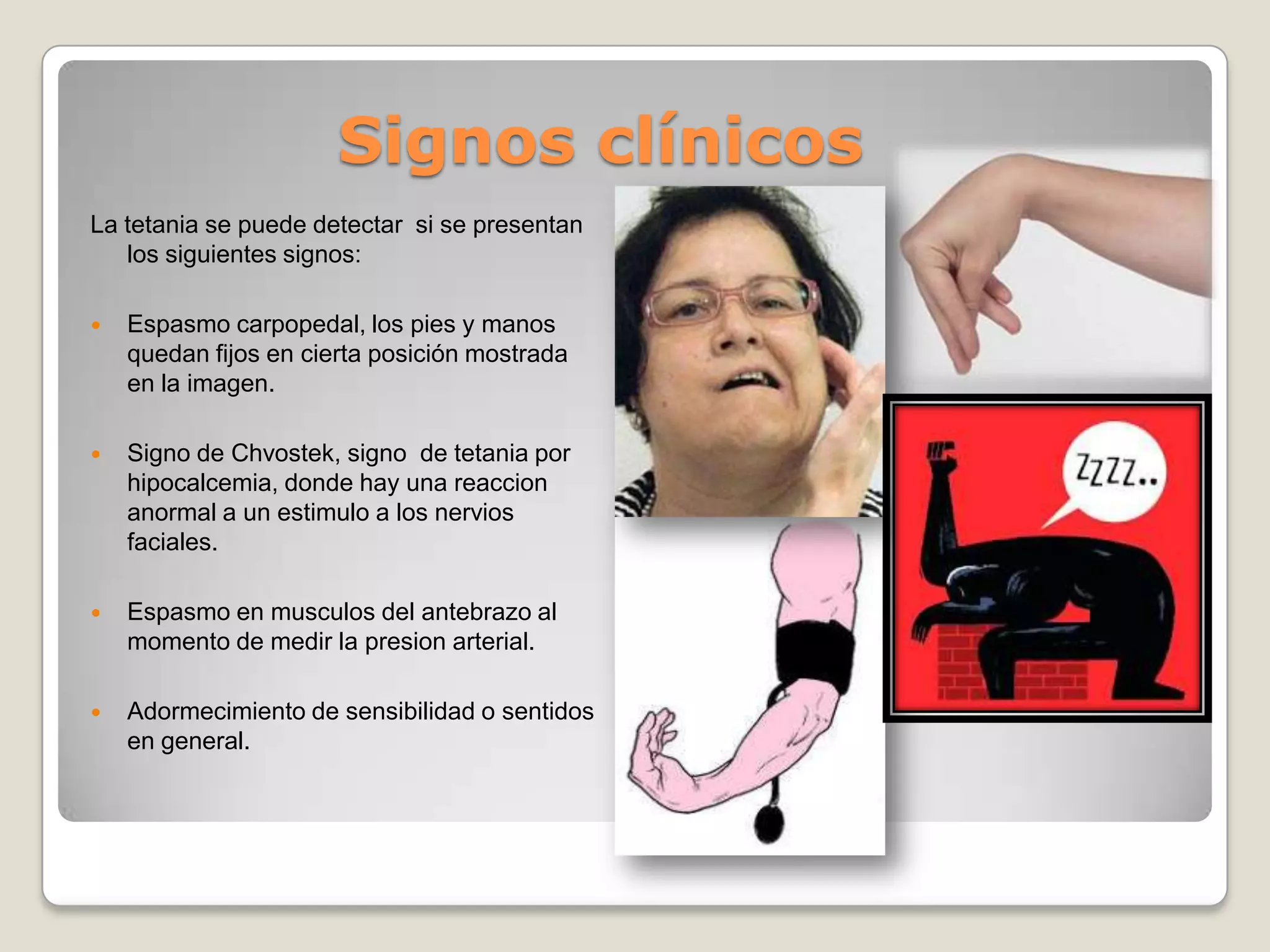 Fisio tetania | PPTX