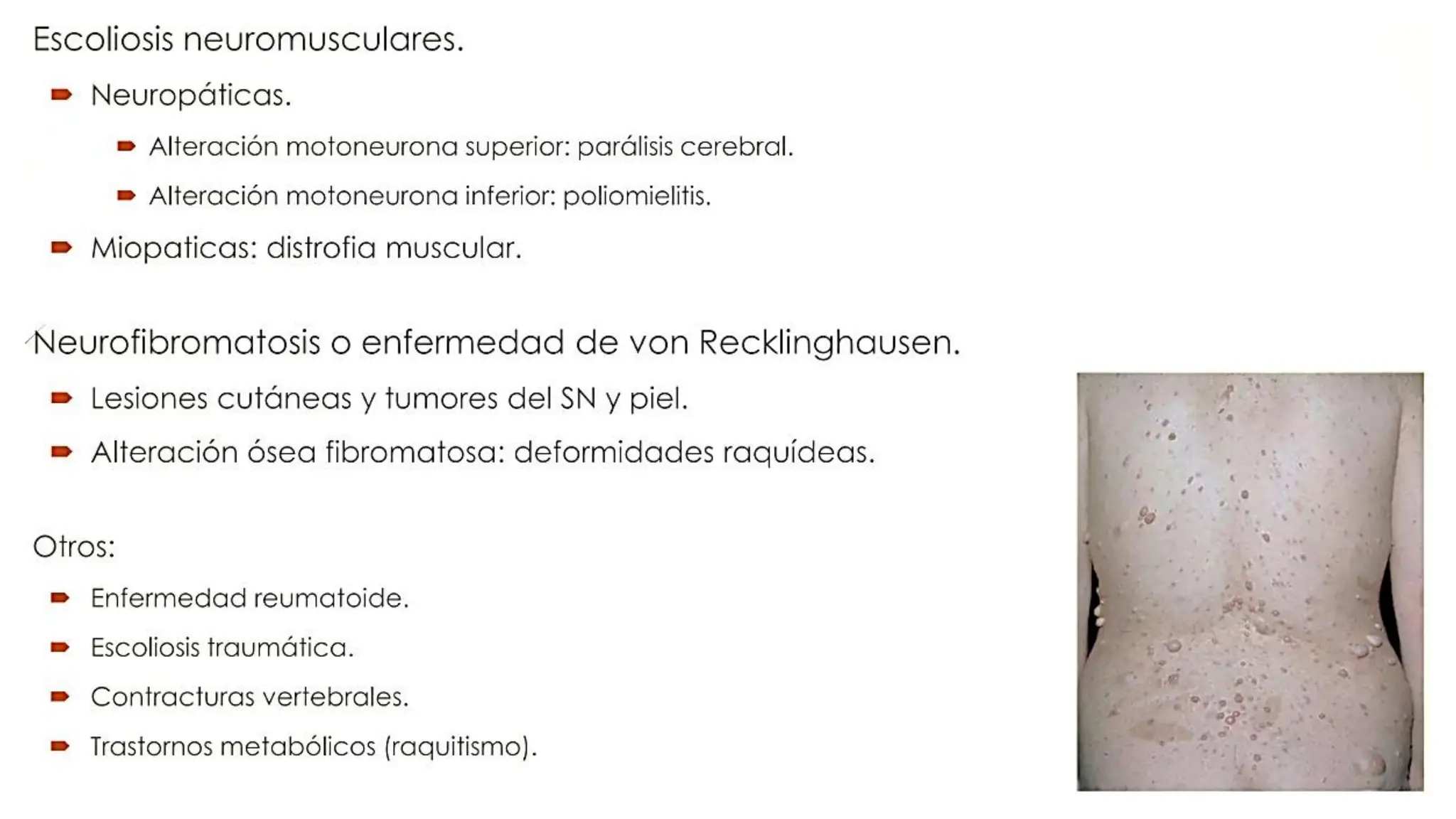 FISIO DE EJERCICIO Y DEFECTOS POSTURALES.pdf