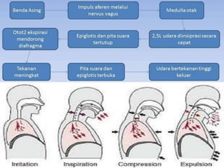 Fisiologi batuk | PPT
