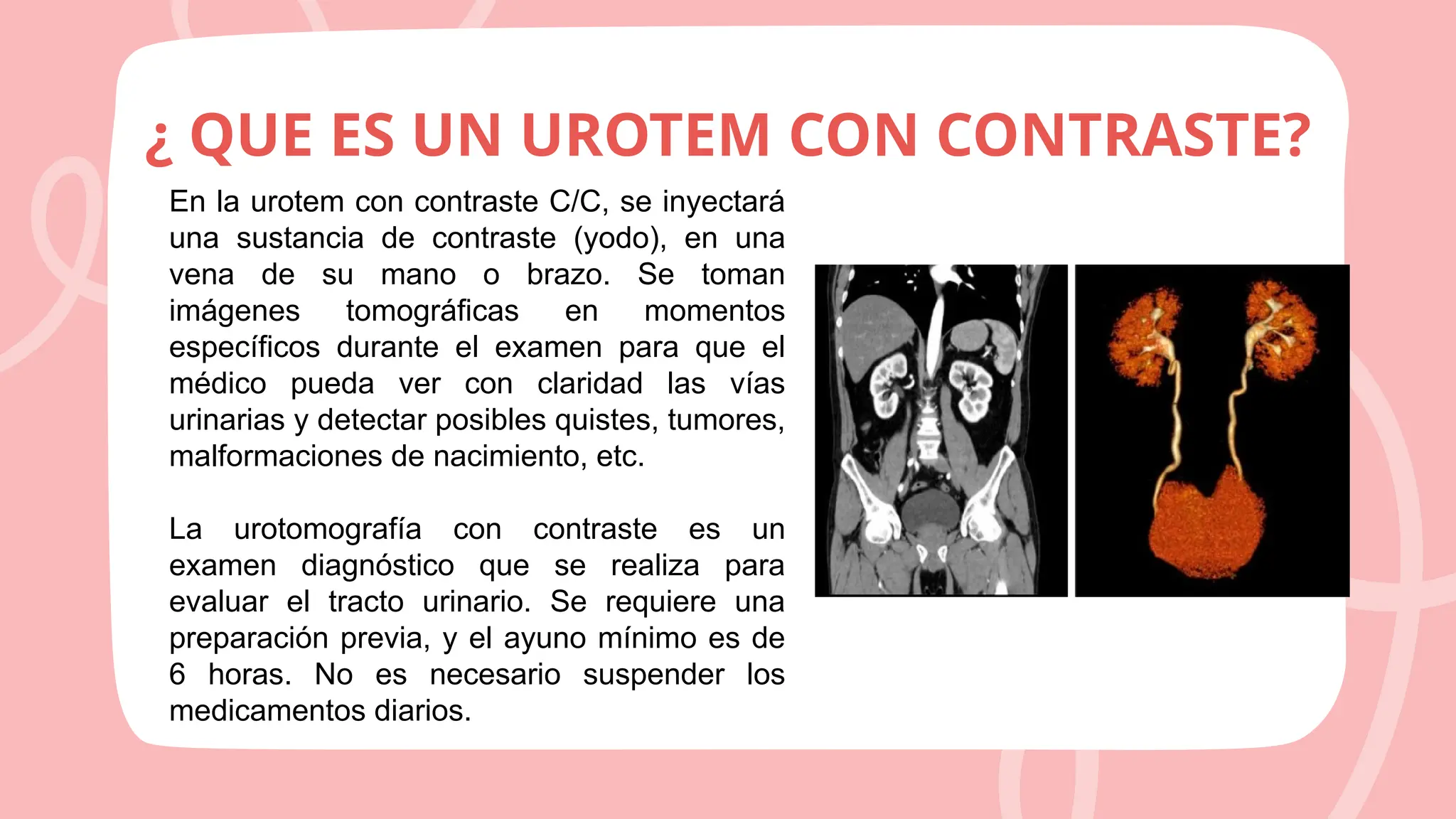 FISIOLOGIA DE LAS VIAS URINARIAS UPLA.pptx