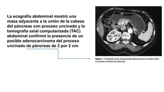 fisiologia del pancreas endocrino 19..pptx