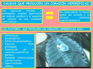 CORAZÓN HIPEREFICAZ | PPTX