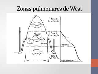 fisiologia pulmonar Y ZONAS DE WEST ANESTESIOLOGIA | PPTX