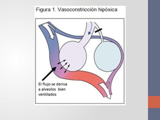 fisiologia pulmonar Y ZONAS DE WEST ANESTESIOLOGIA | PPTX
