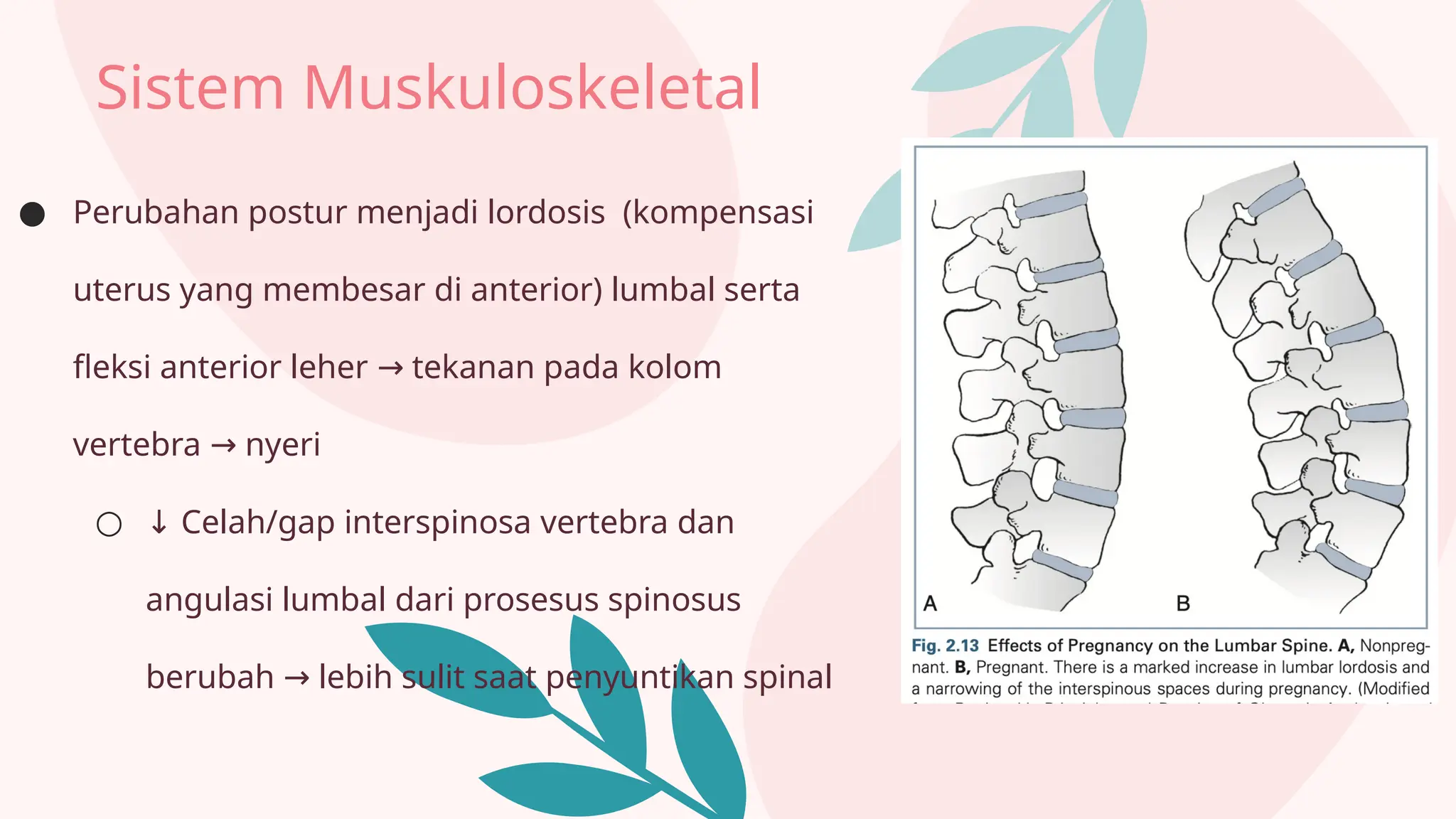 Fisiologi Kehamilan dan Pemilihan Tipe Anestesi | PPTX