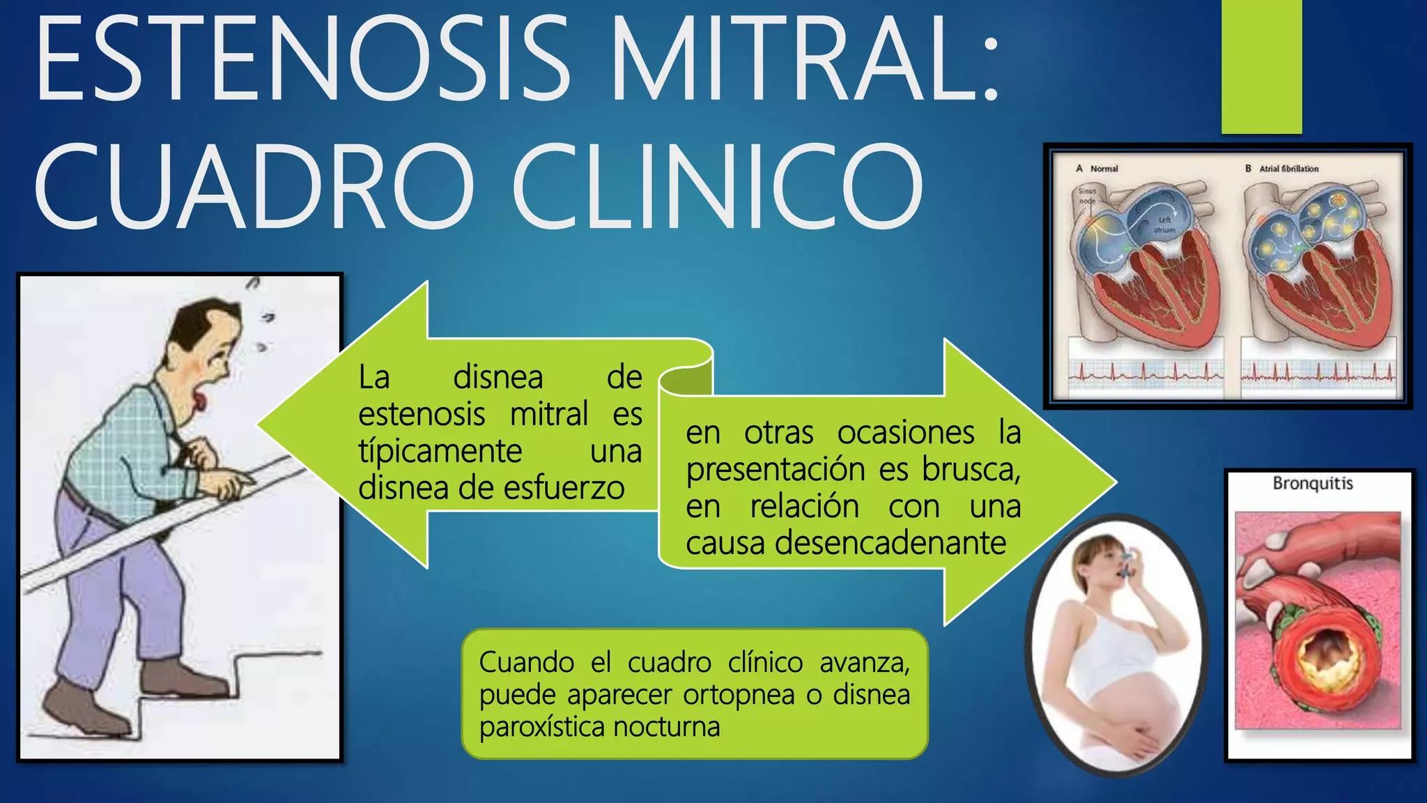 FISIOPATOLOGIA INSUFICIENCIA CARDÍACA, EDEMA PULMONAR Y ESTENOSIS ...