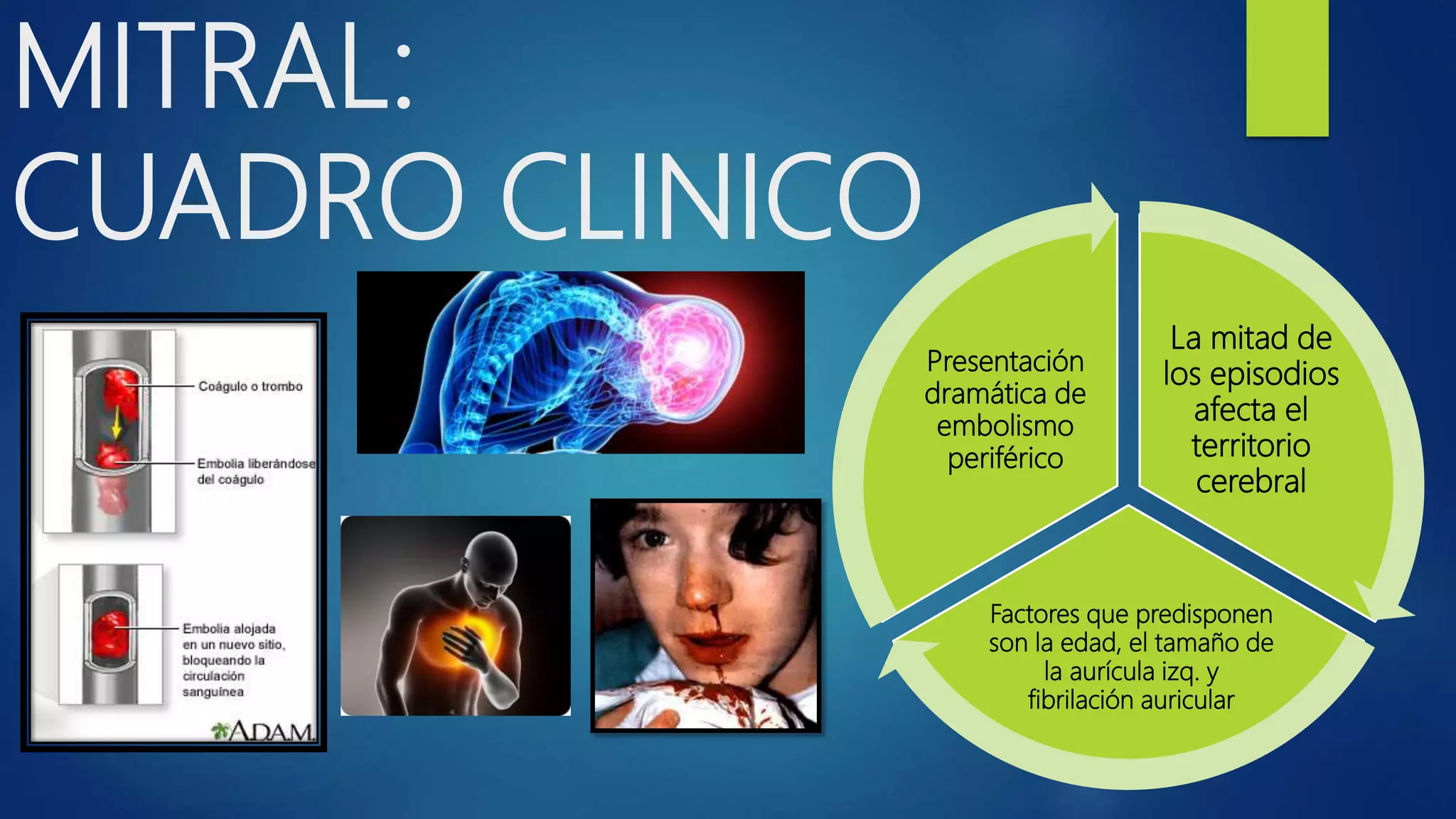 FISIOPATOLOGIA INSUFICIENCIA CARDÍACA, EDEMA PULMONAR Y ESTENOSIS ...