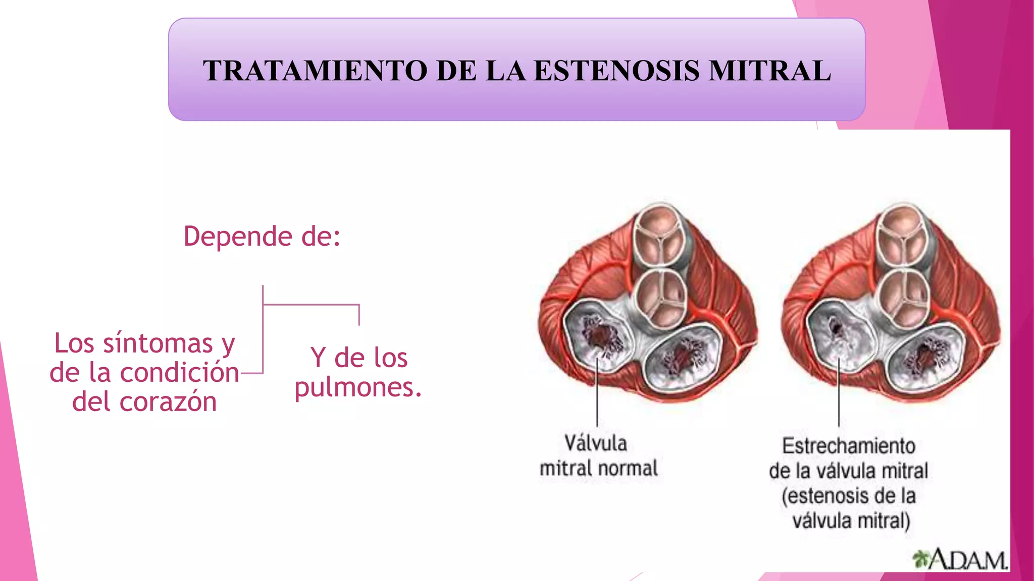FISIOPATOLOGIA INSUFICIENCIA CARDÍACA, EDEMA PULMONAR Y ESTENOSIS ...