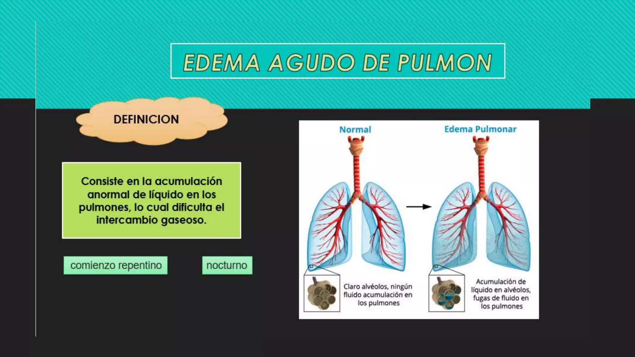FISIOPATOLOGIA INSUFICIENCIA CARDÍACA, EDEMA PULMONAR Y ESTENOSIS ...
