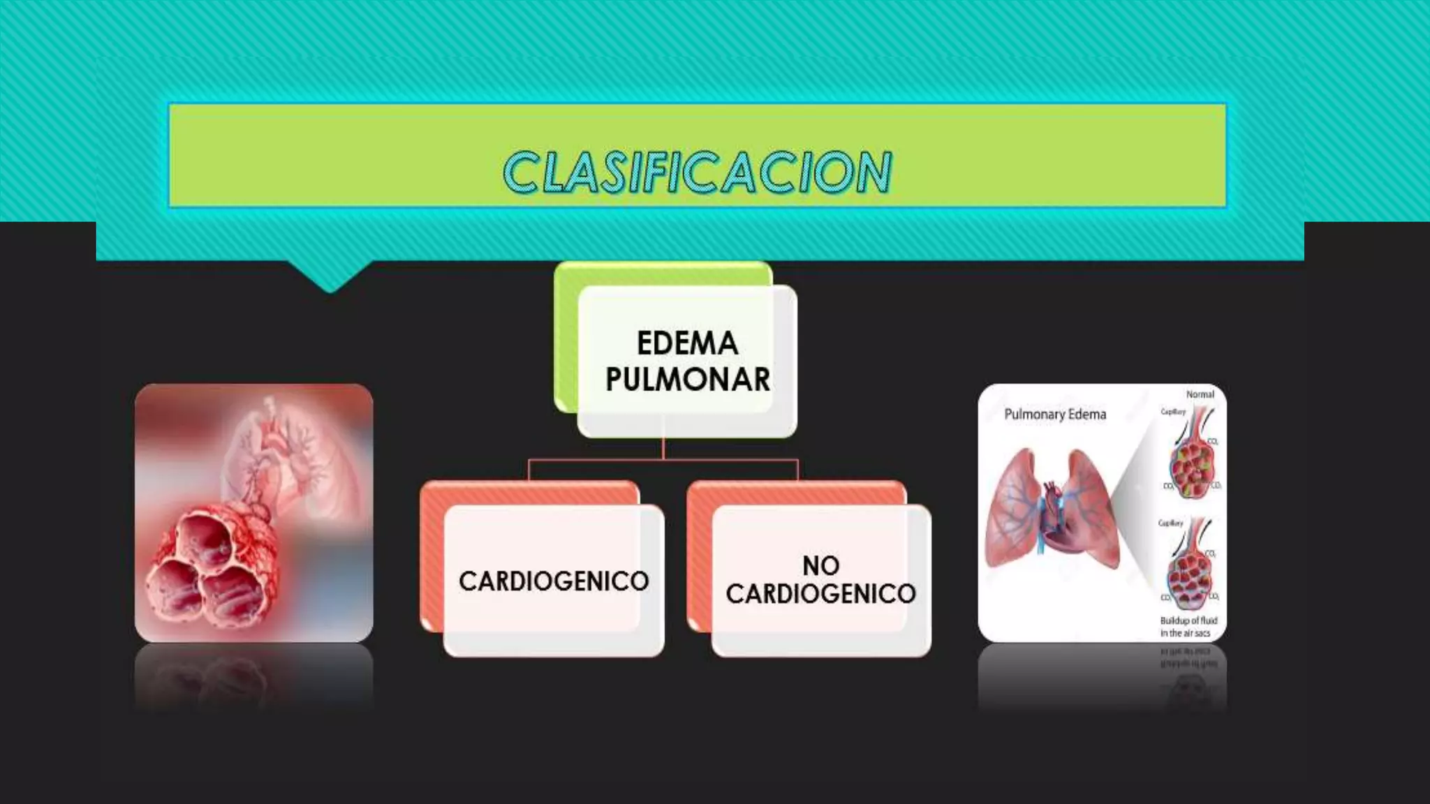 FISIOPATOLOGIA INSUFICIENCIA CARDÍACA, EDEMA PULMONAR Y ESTENOSIS ...