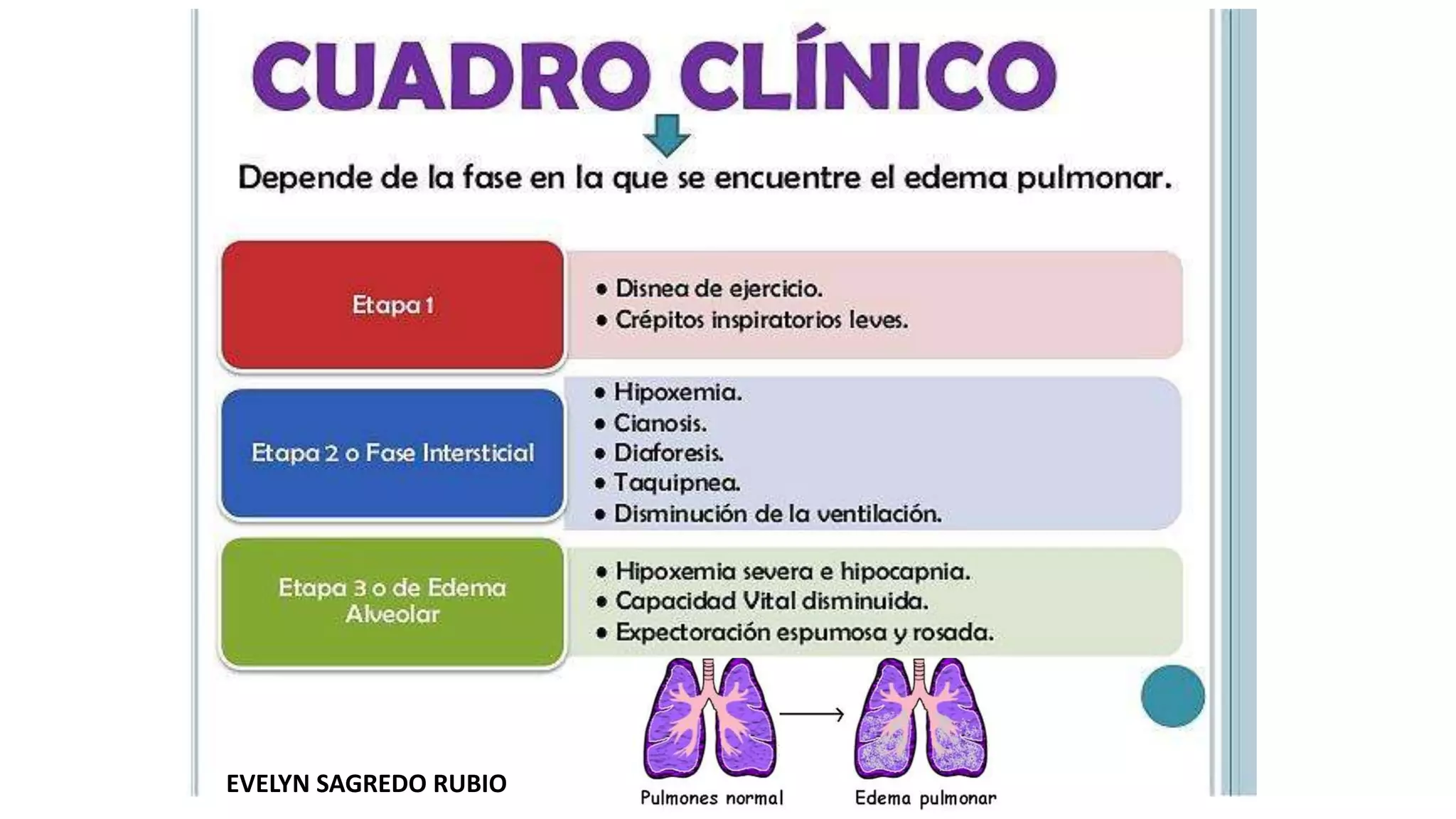 FISIOPATOLOGIA INSUFICIENCIA CARDÍACA, EDEMA PULMONAR Y ESTENOSIS ...