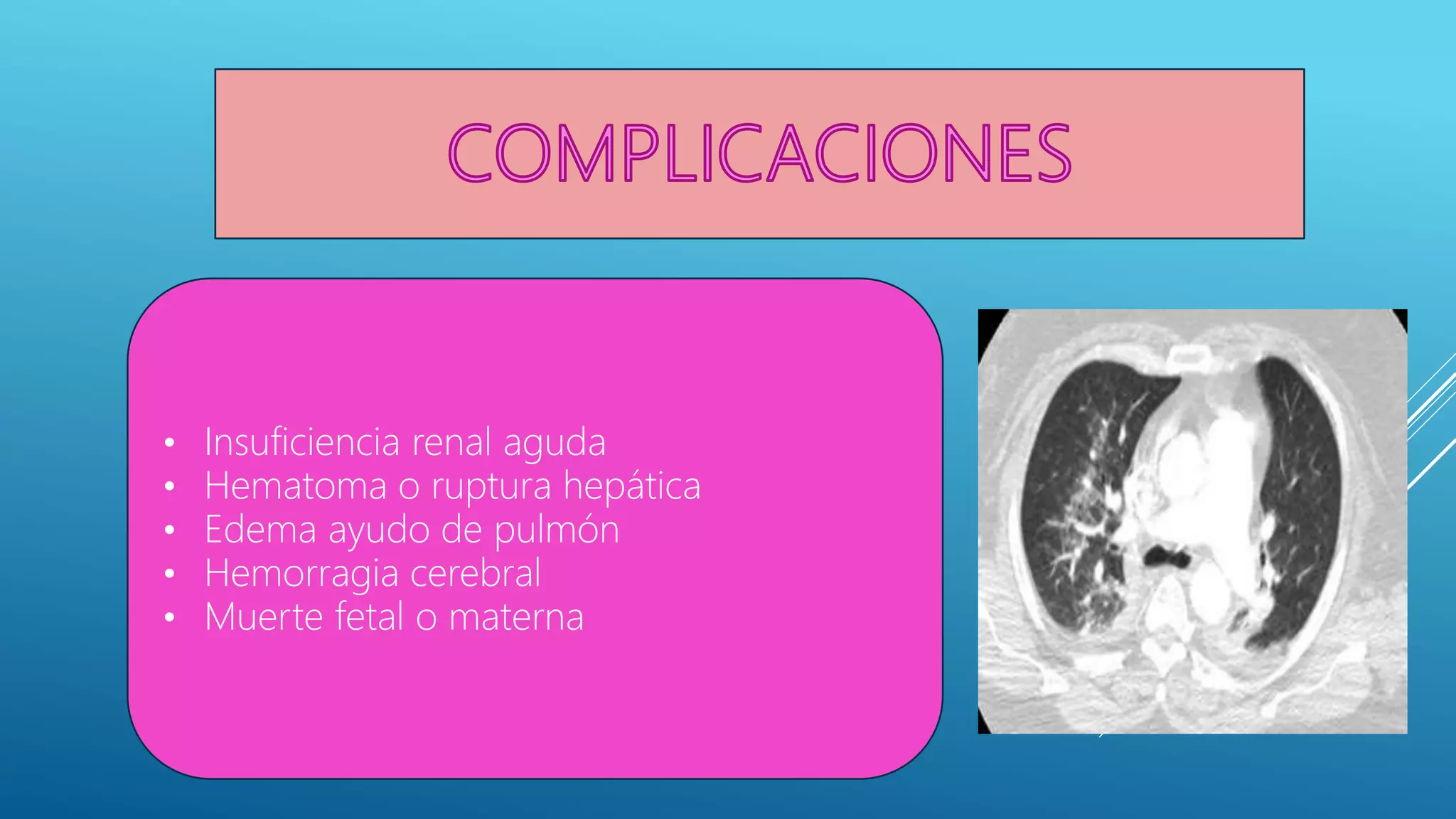 FISIOPATOLOGIA INSUFICIENCIA CARDÍACA, EDEMA PULMONAR Y ESTENOSIS ...