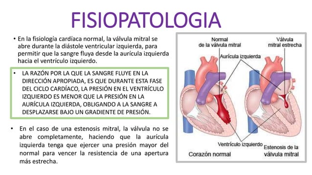 FISIOPATOLOGIA INSUFICIENCIA CARDÍACA, EDEMA PULMONAR Y ESTENOSIS ...
