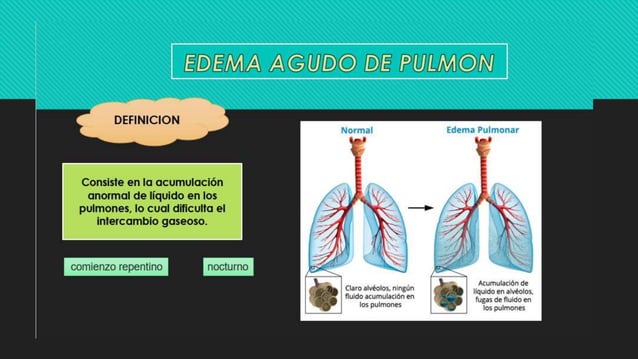 FISIOPATOLOGIA INSUFICIENCIA CARDÍACA, EDEMA PULMONAR Y ESTENOSIS ...