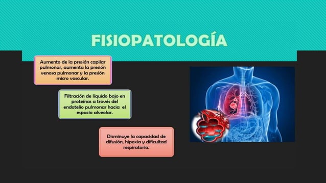 FISIOPATOLOGIA INSUFICIENCIA CARDÍACA, EDEMA PULMONAR Y ESTENOSIS ...