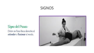 FISIOPATOLOGÍA DE LA APENDICITIS.pptxdwad | PPTX