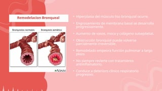 Fisiopatología De Las Vías Respiratorias Inferiores Pptx