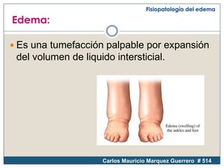 Fisiopatología del edema | PPTX