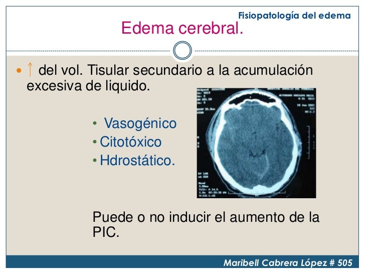 Fisiopatología del edema