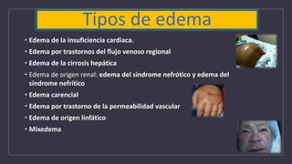 Fisiopatología del edema | PPTX