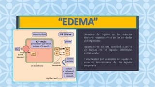 Fisiopatología del edema | PPTX
