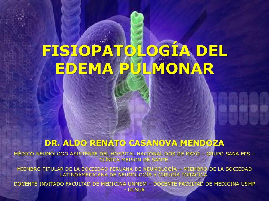 Edema Pulmonar
