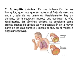 FISIOPATOLOGÍA DEL SISTEMA RESPIRATORIO.pptx