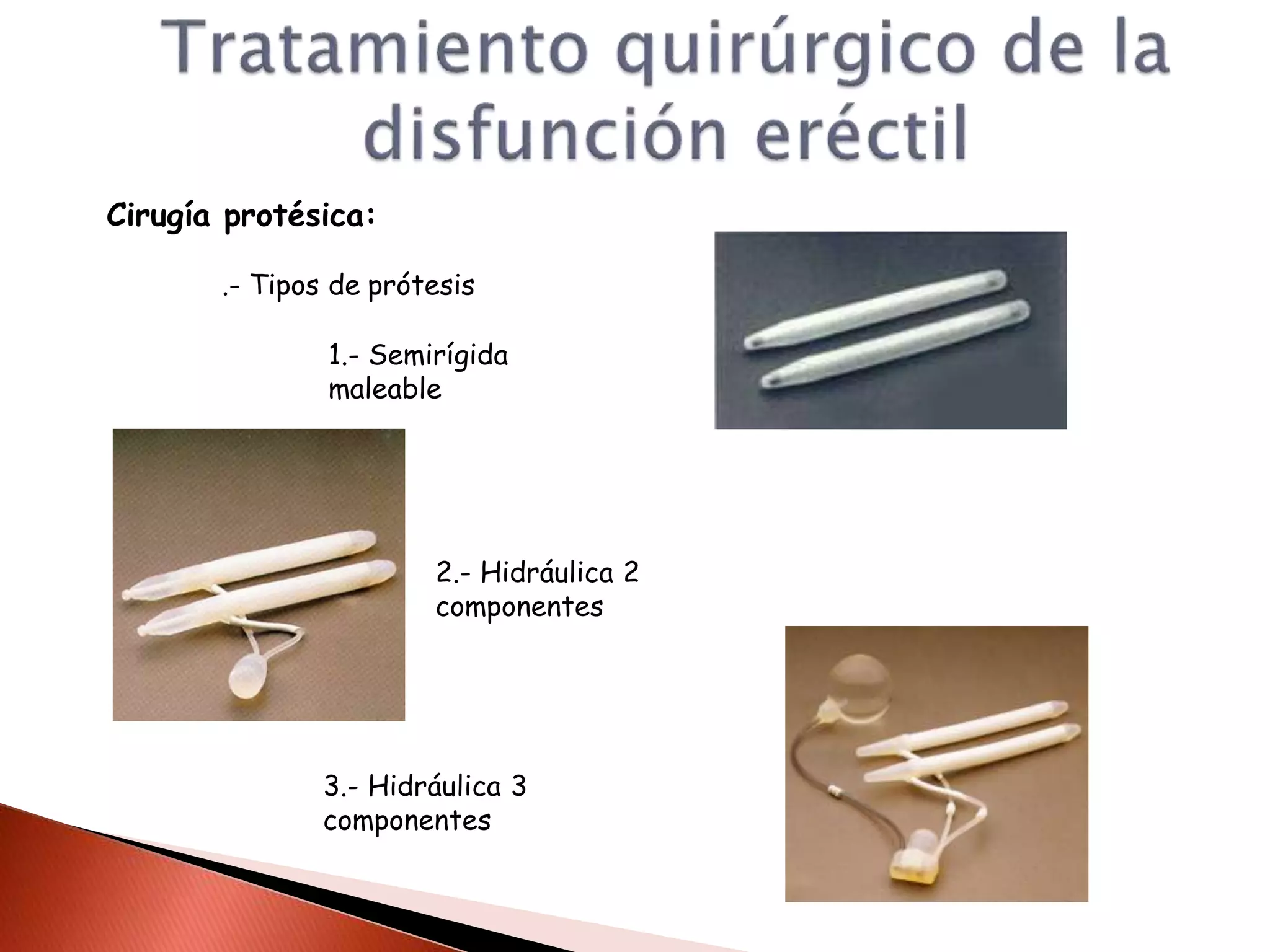 Fisiopatología, diagnóstico y tratamiento de la disfunción erectil ...