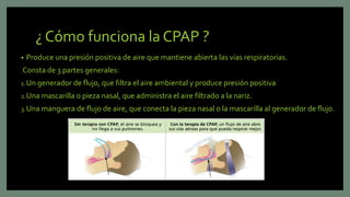 Fisiopatología y soporte ventilatorio no invasivo.pptx