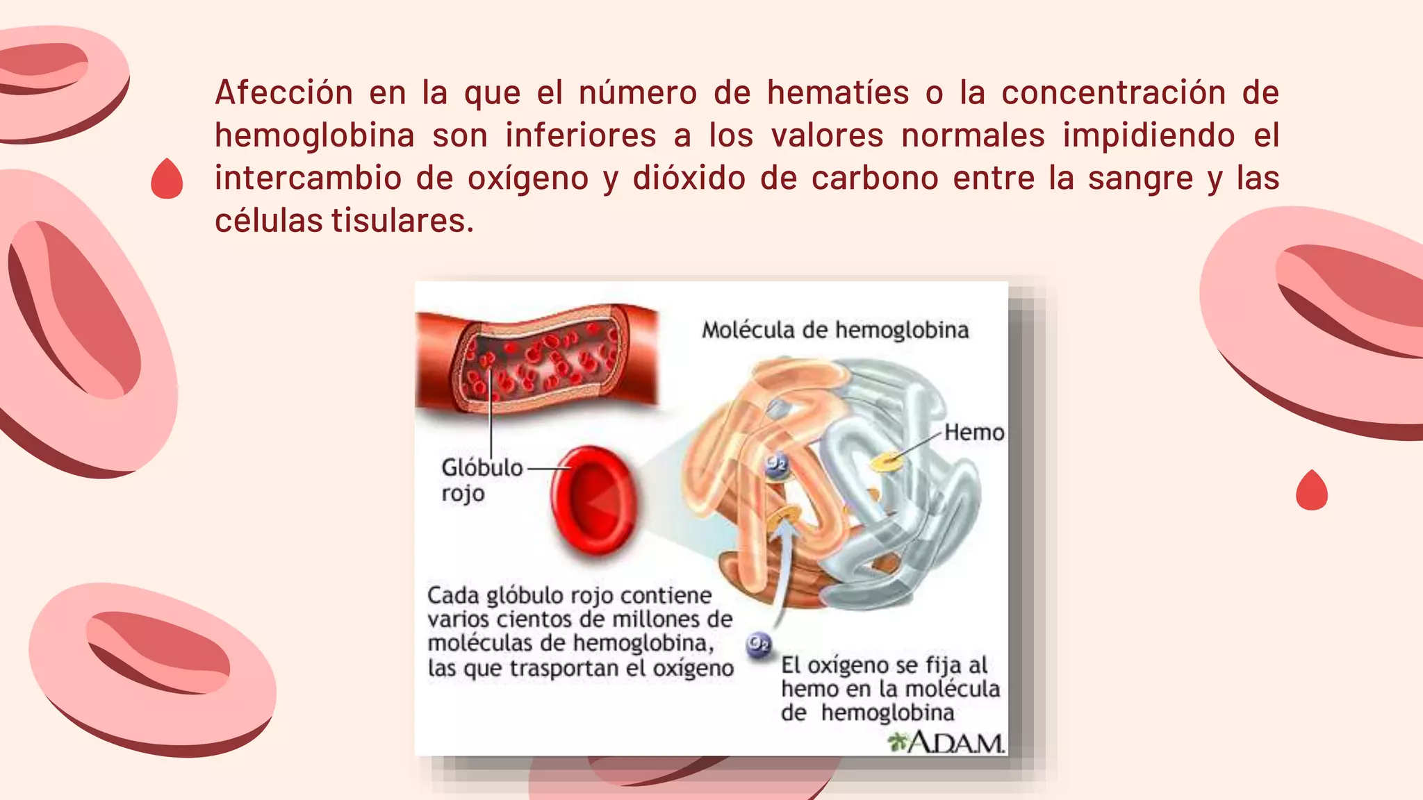 Fisiopatologia -Anemia.pptx